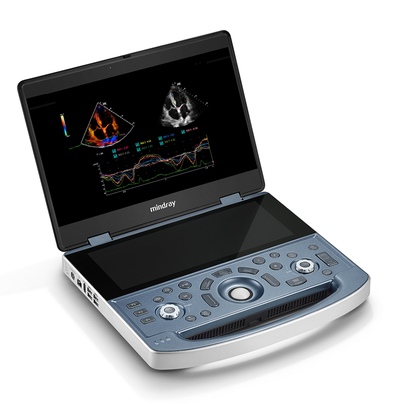 Mindray MX7 – ¡Nuevo Producto! – Digimed Ultrasonido