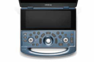 Mindray MX7 – ¡Nuevo Producto! – Digimed Ultrasonido