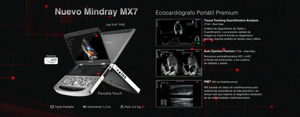 Mindray MX7 – Digimed