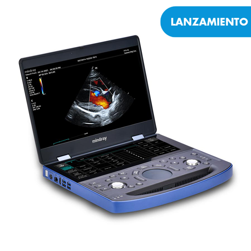Mindray Vetus E7 – Nuevo Portátil Premium – Digimed Ultrasonido